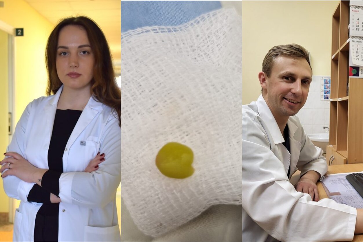 „Žirnio plaučiuose istorija“: metus dėl plaučių uždegimo gydytas ...